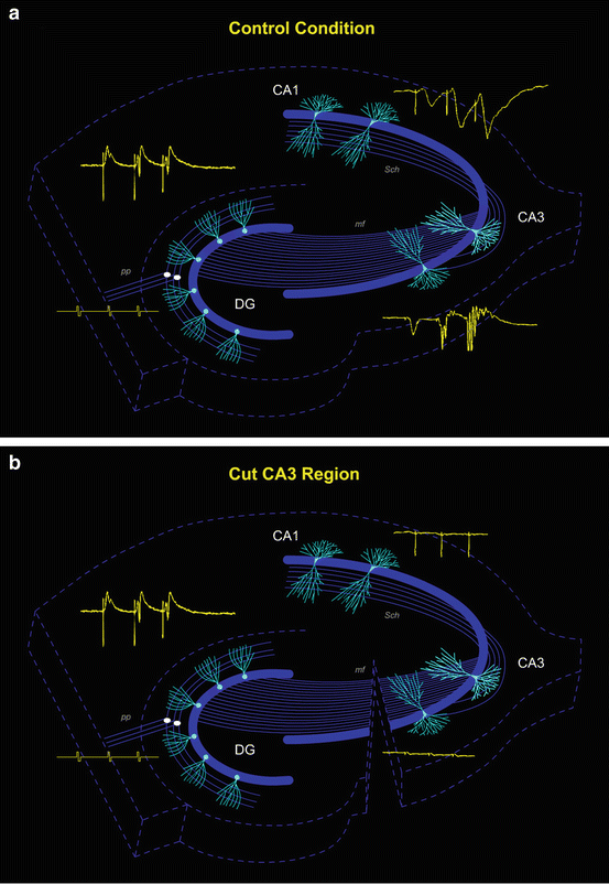 Hippocampal Microcircuits Functional Connectivity And Prostheses