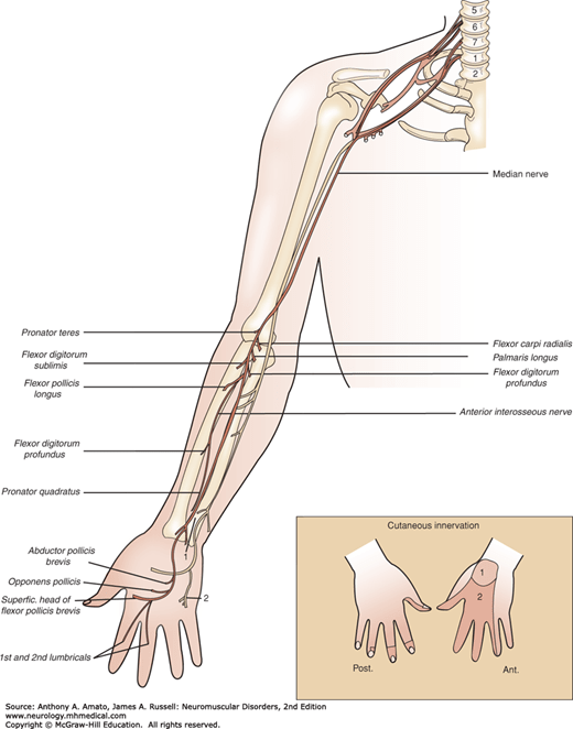 Focal Neuropathies Of The Upper Extremities And Trunk Radiculopathies