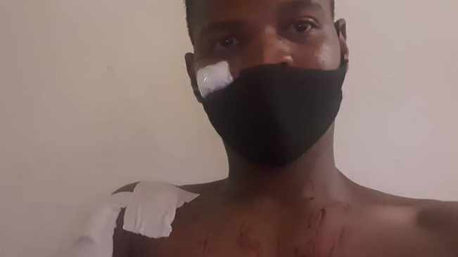 Durban Robbery Victim Angry After His Cellphone And 2 Suspects Cops