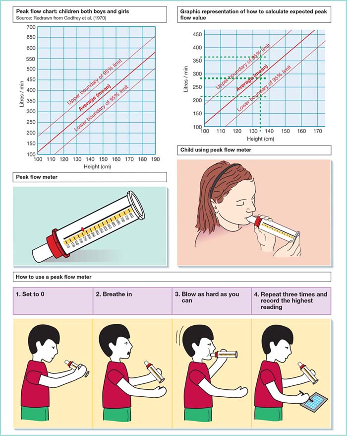 Peak Expiratory Flow Nurse Key