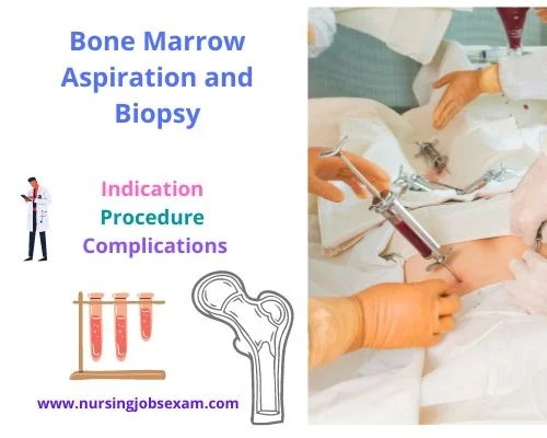 Bone Marrow Aspiration And Biopsy Indication Procedure Complications