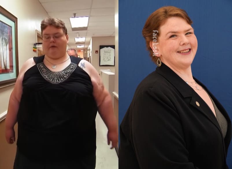 20 Incredible Before And After Photos From My 600 Lb