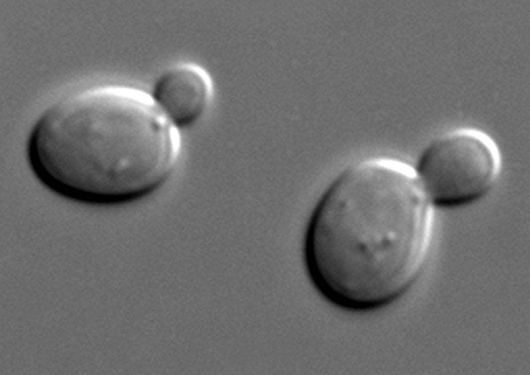 Yeast Morphology Primer Yeast Under The Brewery Microscope