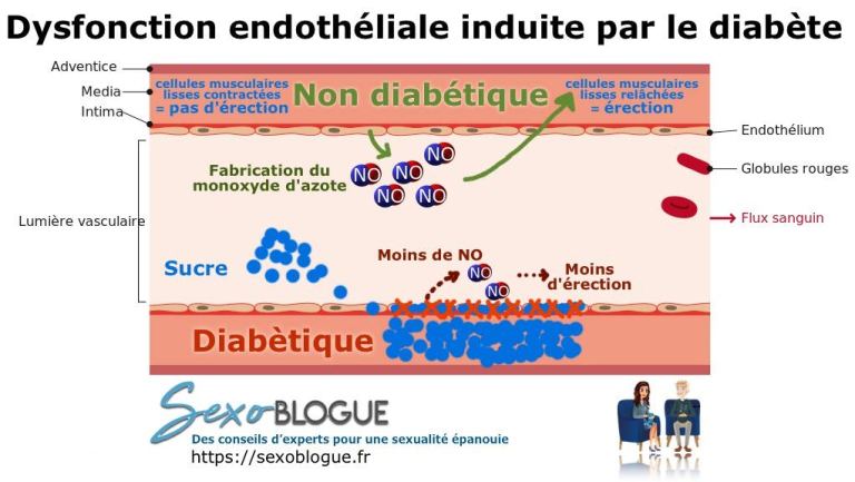 Retentissement Du Diabète Sur La Sexualité Sexoblogue