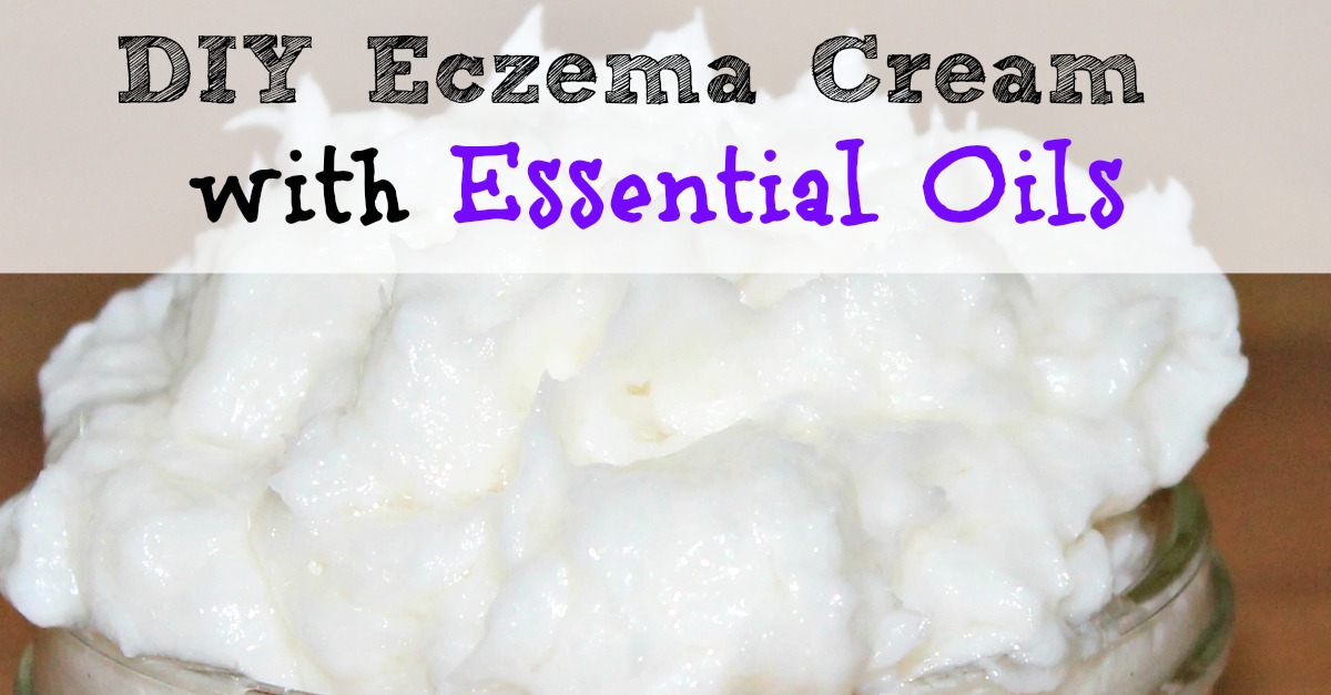 Best Diy Homemade Eczema Cream With Essential Oils