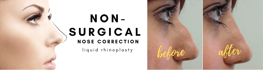 Nose Correction Skin Smile Clinic