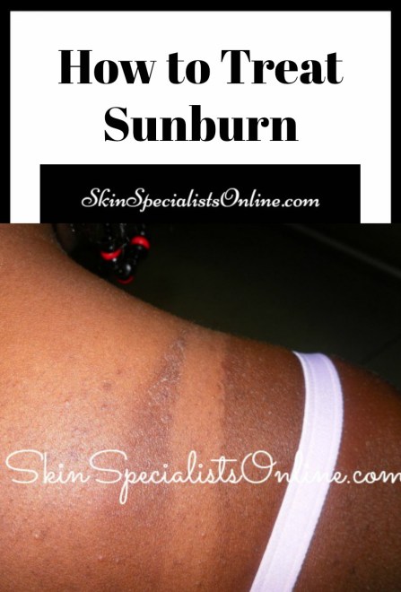 Sunburn Skin Specialists Online