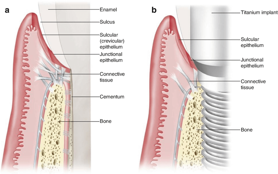 Introduction To Understanding The Basics Of Teeth Vs Dental Implants