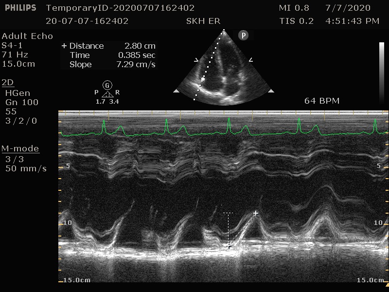 Basic Cardiac Views Skh教學 Pocus Academy