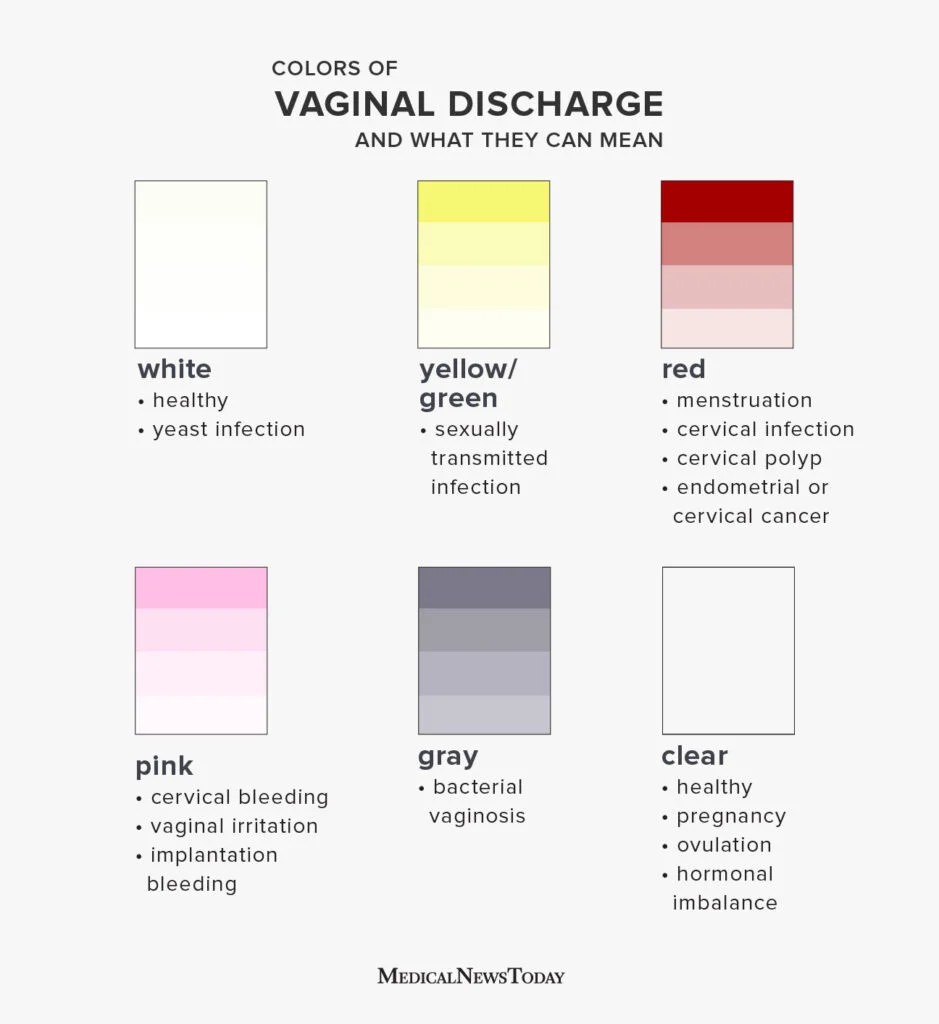 Vaginal Discharge Color Chart