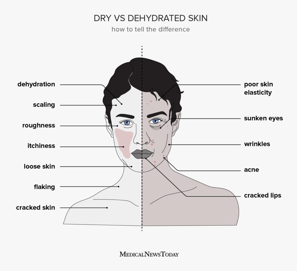 Dehydrated Vs Dry Skin Differences And More