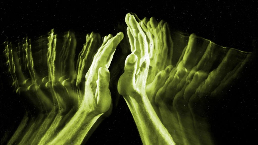 Alien Hand Syndrome What It Is Causes And Diagnosis