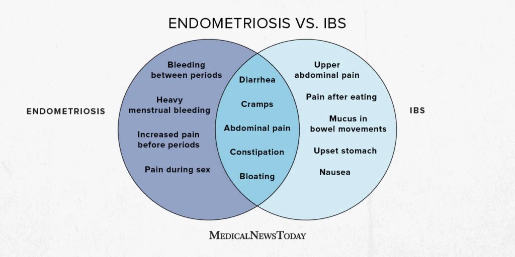 Endometriosis Vs Ibs Differences Similarities And More