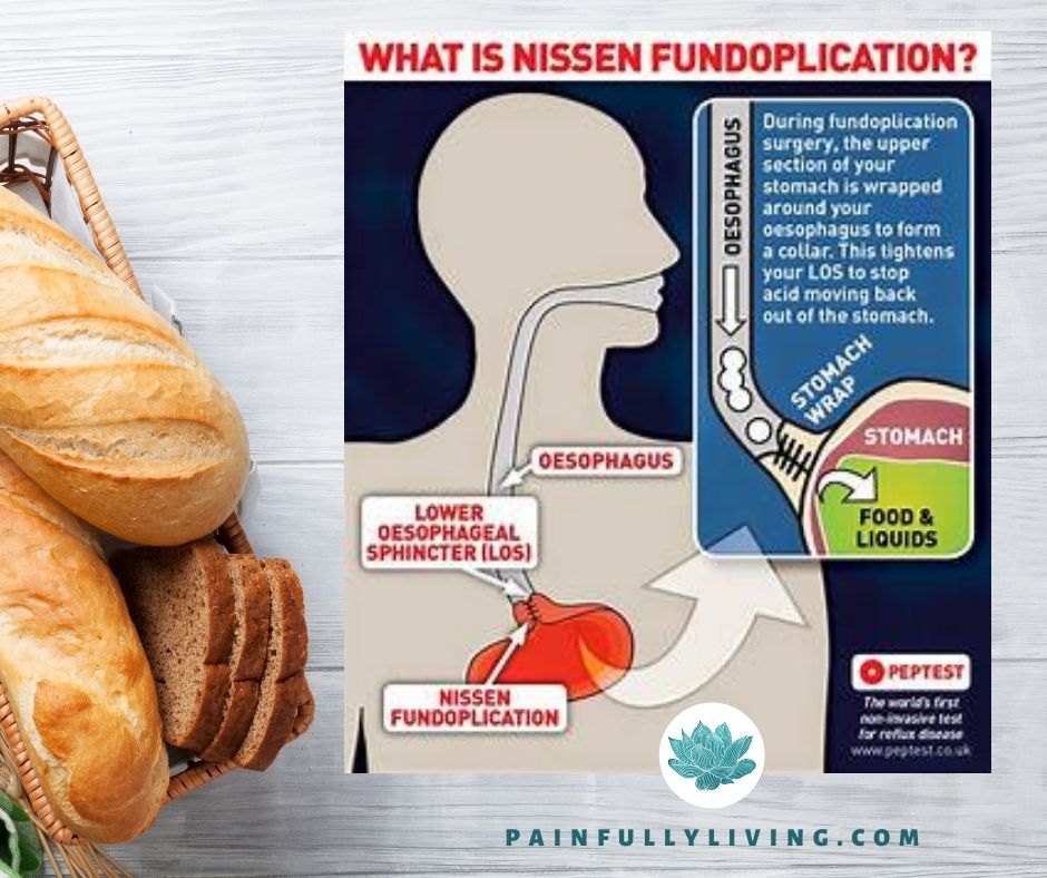 Fibromyalgia Impact Of Going Gluten Free Pain Fully Living