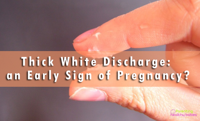 Thick White Discharge Is A Sign Of Pregnancy Prnso