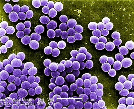 Difference Between Micrococcus And Staphylococcus Pediaacom