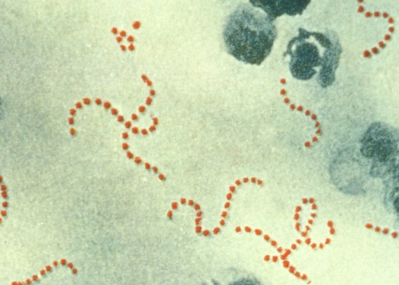 What Is The Difference Between Staphylococcus Aureus And Streptococcus