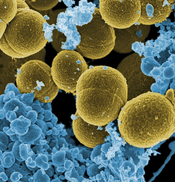 What Is The Difference Between Staphylococcus Aureus And Enterococcus