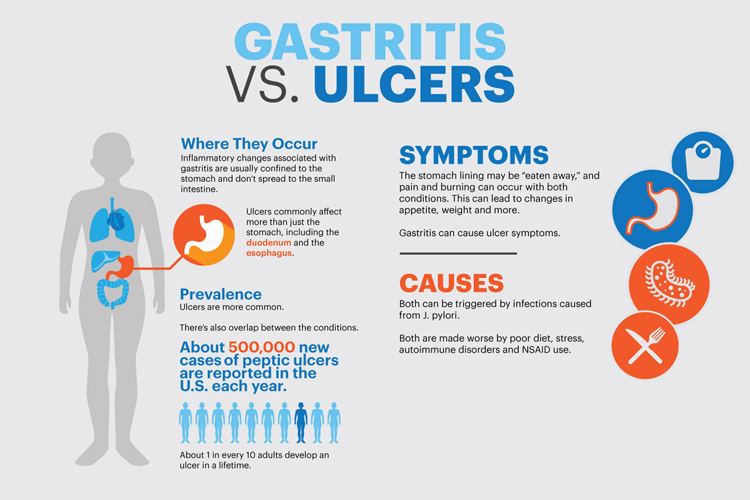 Treatment For Gastritis Philadelphia Holistic Clinic Dr Tsan