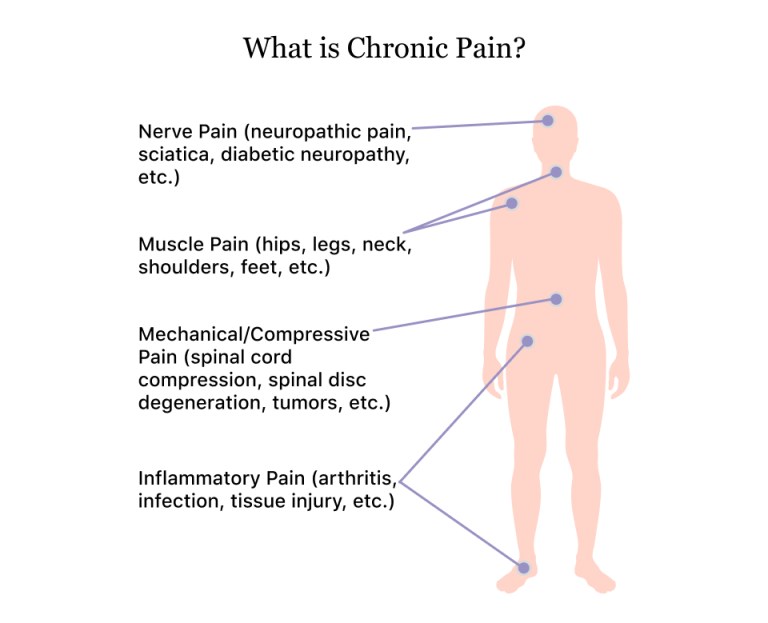 Chronic Pain In Men And Women Philadelphia Holistic Clinic Dr Tsan