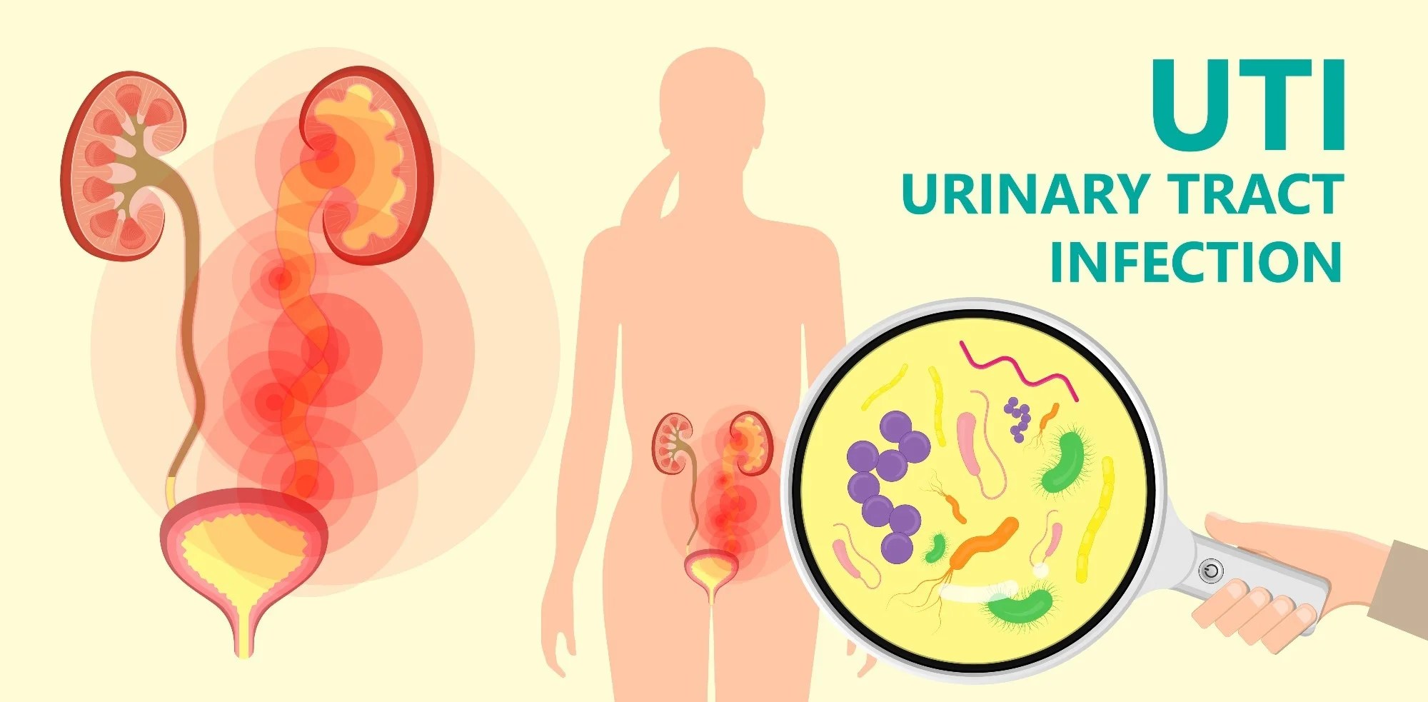 Natural Remedies For Uti Philadelphia Holistic Clinic Dr Tsan