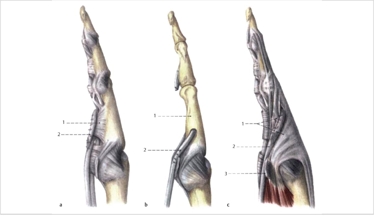 9 Tendon Transfers For Low Ulnar Nerve Palsy Plastic Surgery Key