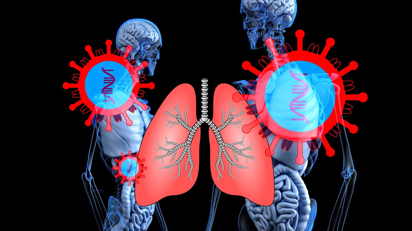 Síntomas Causas Y Tratamiento Del Cáncer De Pulmón