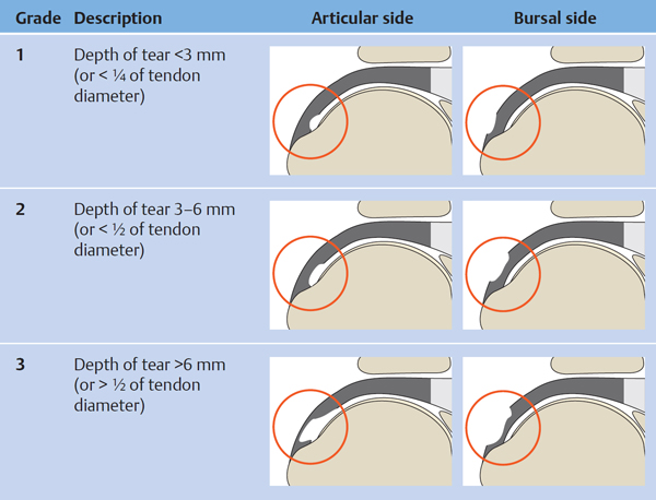 Shoulder Joint Radiology Key