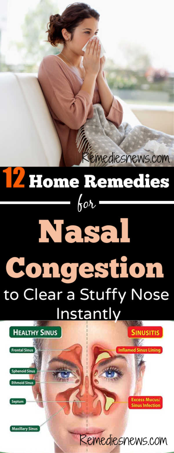 12 Home Remedies For Nasal Congestion To Clear A Stuffy Nose Instantly