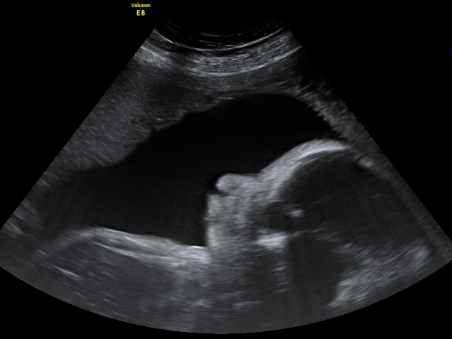 Image Gallery 4d Ultrasound Scottsboro Alabama 3d Ultrasound