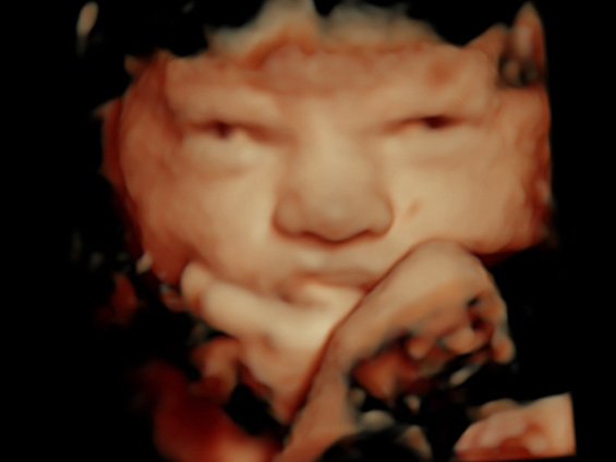 Image Gallery 4d Ultrasound Scottsboro Alabama 3d Ultrasound