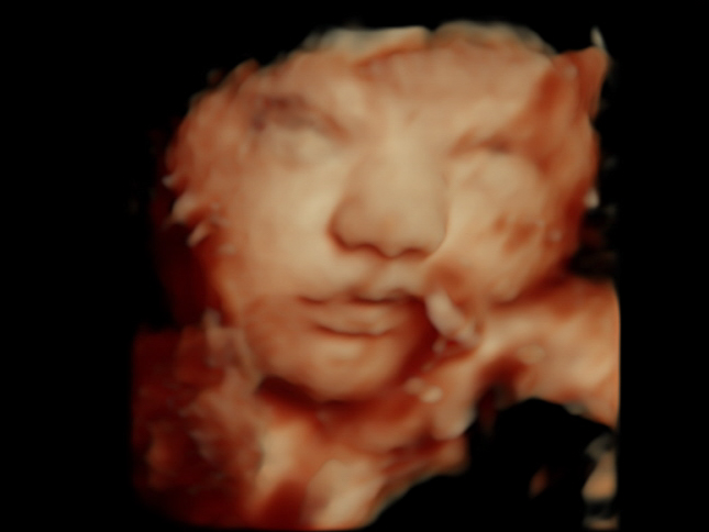 Image Gallery 4d Ultrasound Scottsboro Alabama 3d Ultrasound