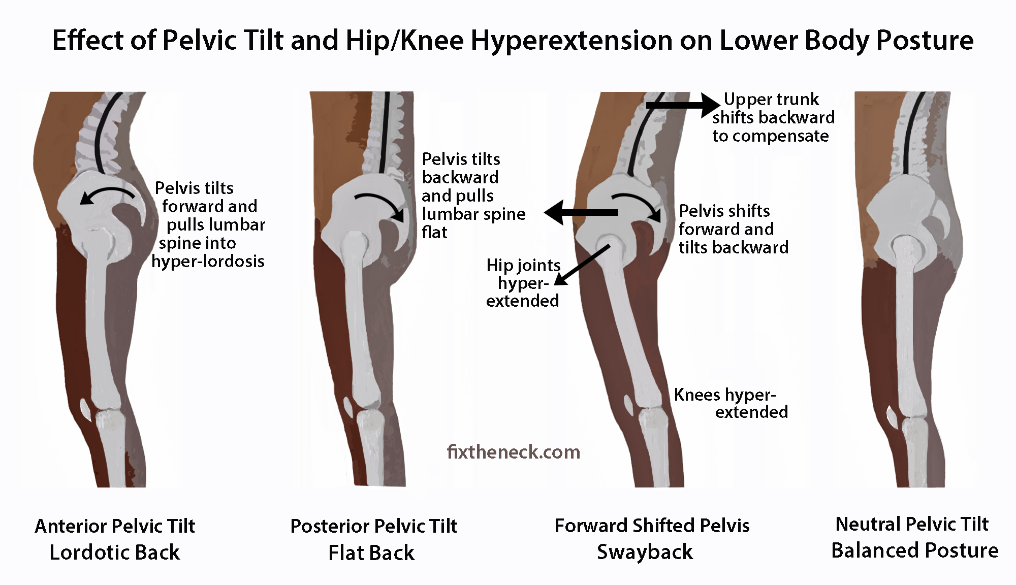 Pelvic Tilt