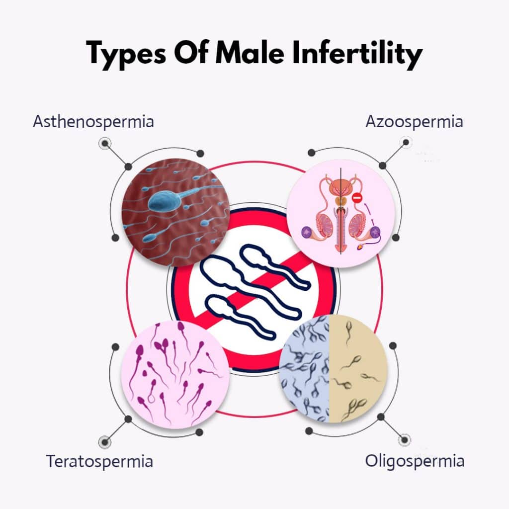 The Causes Of Male Infertility Ii Male Infertility Treatment