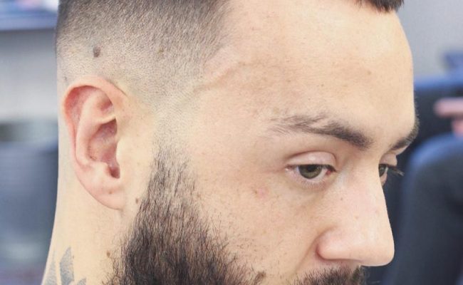 7 Receding Hairline Haircuts That Look Great Conceal Hair Loss Otosection