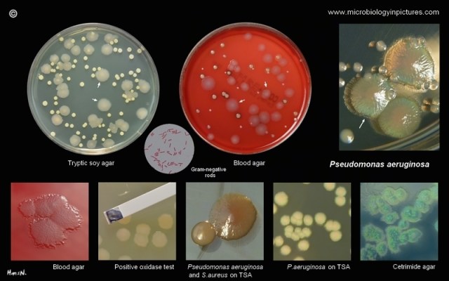 Pseudomonas Aeruginosa Infections Pathogenesis And Lab Diagnosis