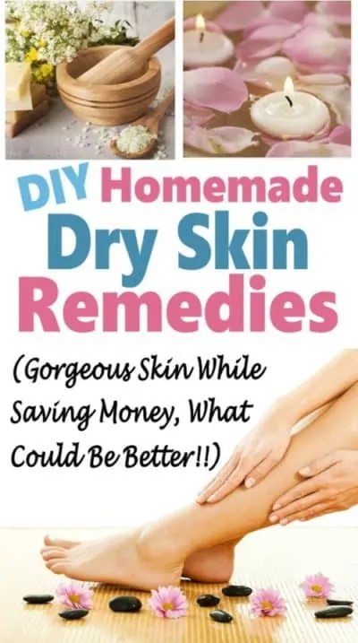 Diy Homemade Dry Skin Remedies ~ Save Money With These Easy Diy Remedies