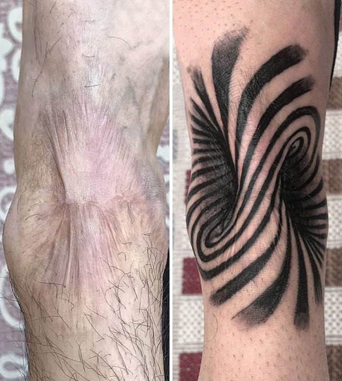 Tattoo Artists Created Amazing Scar And Birthmark Cover Up Tattoos