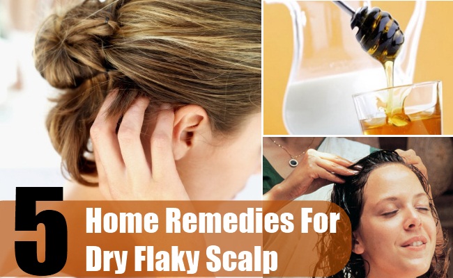 Top 5 Dry Flaky Scalp Home Remedies Natural Treatments And Cures For