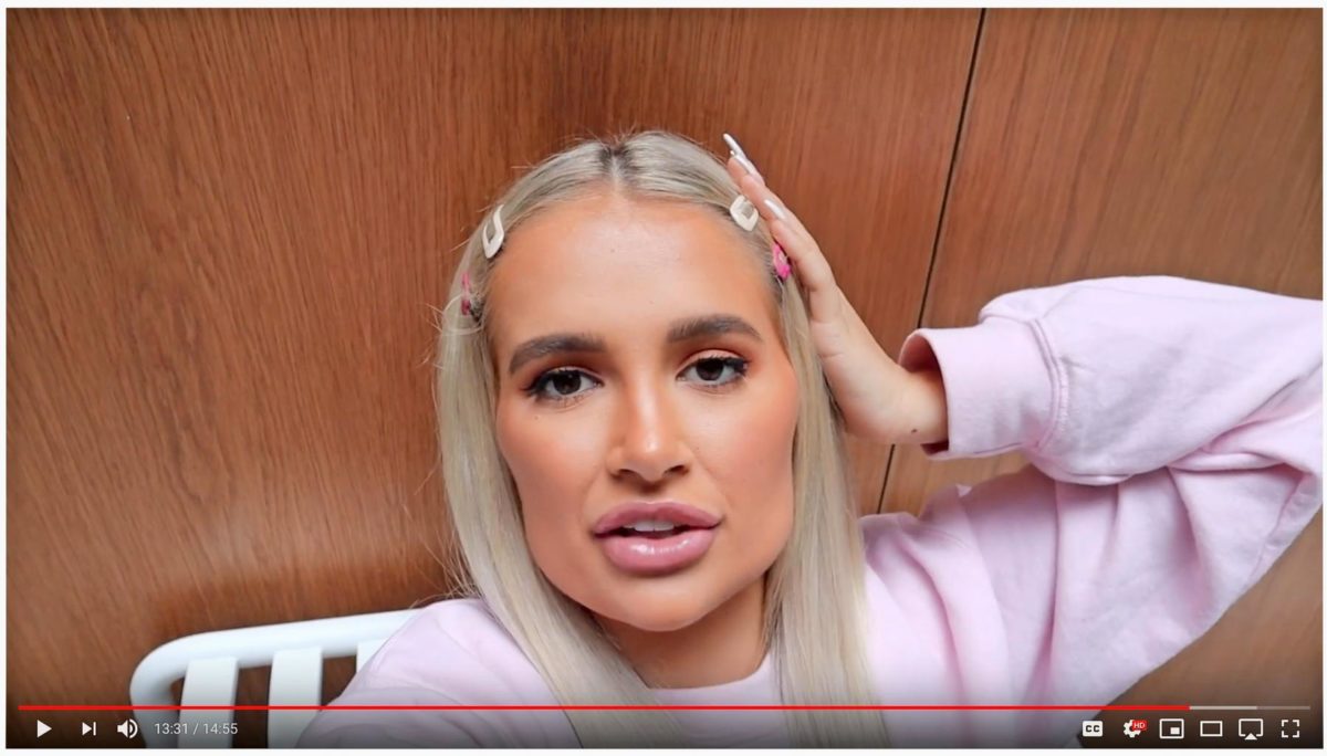 Molly Mae Transformation Gets Lip Fillers Dissolved Buzzpopdaily