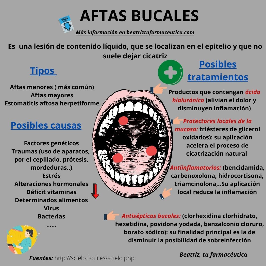 Alfas Llagas Bucales Lo Que Debes Saber Sobre Ellas Beatriz Tu