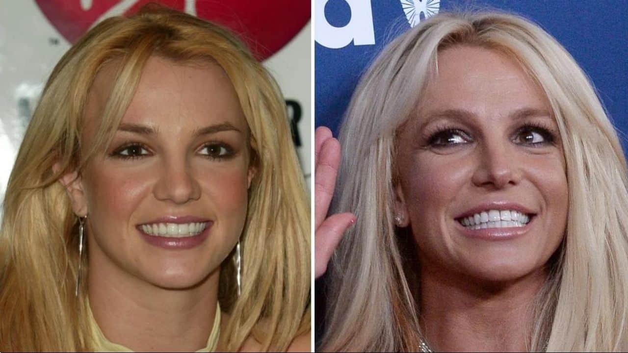 Britney Spears Plastic Surgery Before And After Photos