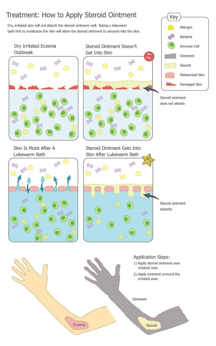 What Is The Difference Between Acne And Eczema Compare The Difference