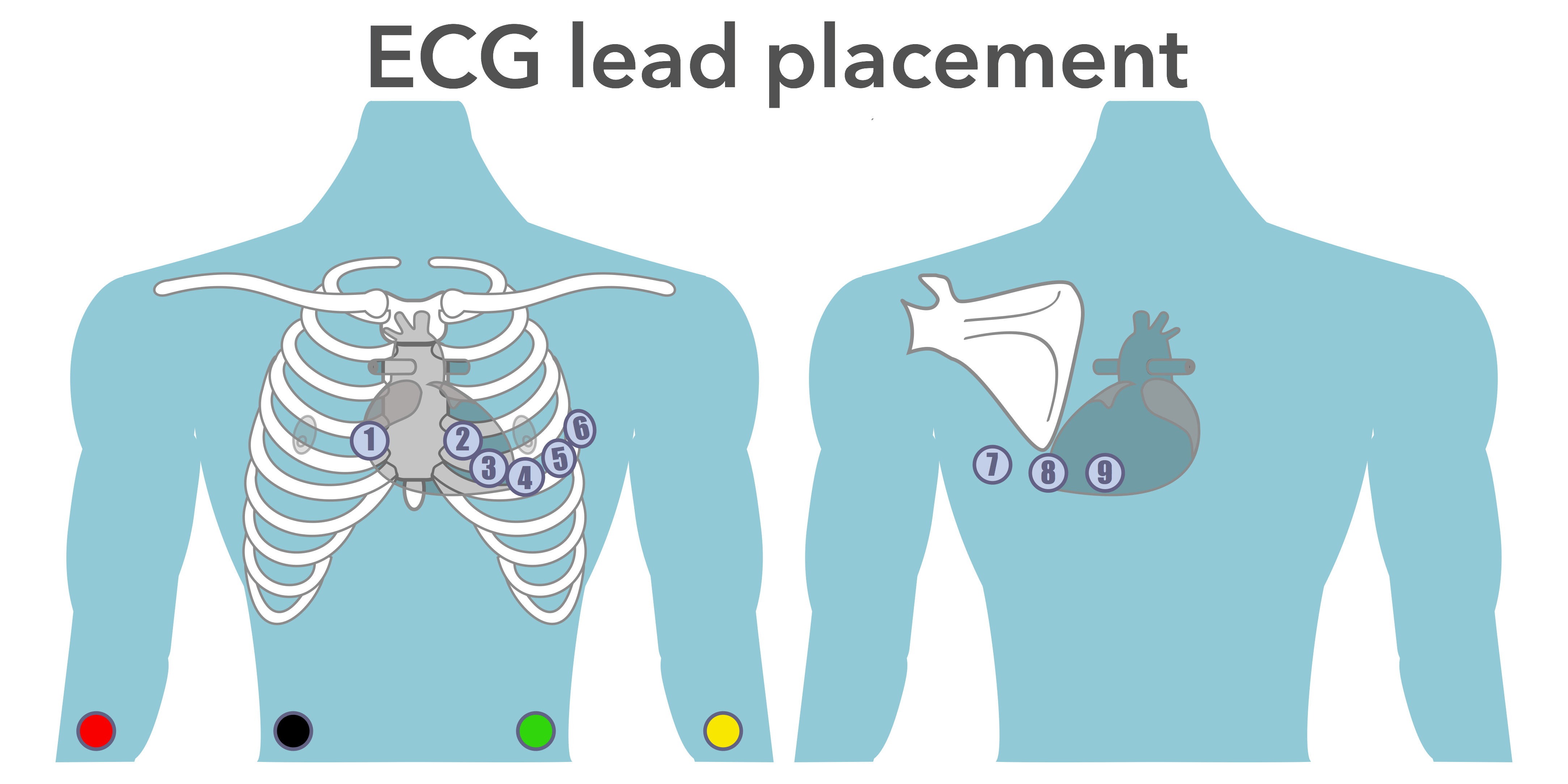 Ecg Placement And Mis Leading Ecgs Uk