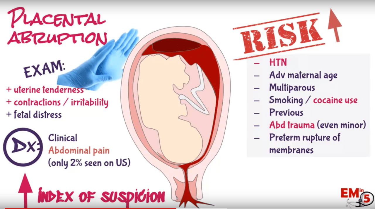 Emergency Medicine Educationem In 5 Third Trimester