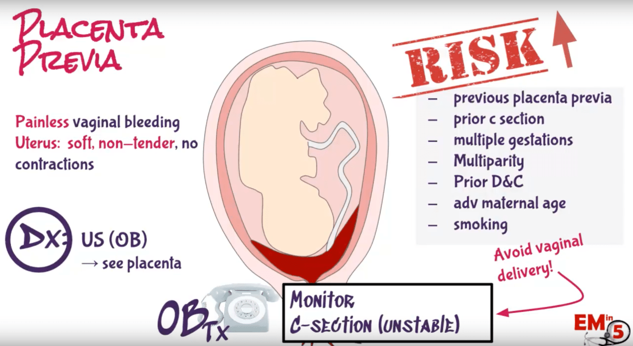 Emergency Medicine Educationem In 5 Third Trimester