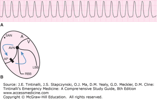 Emergency Medicine Educationecg Pointers Syncope And