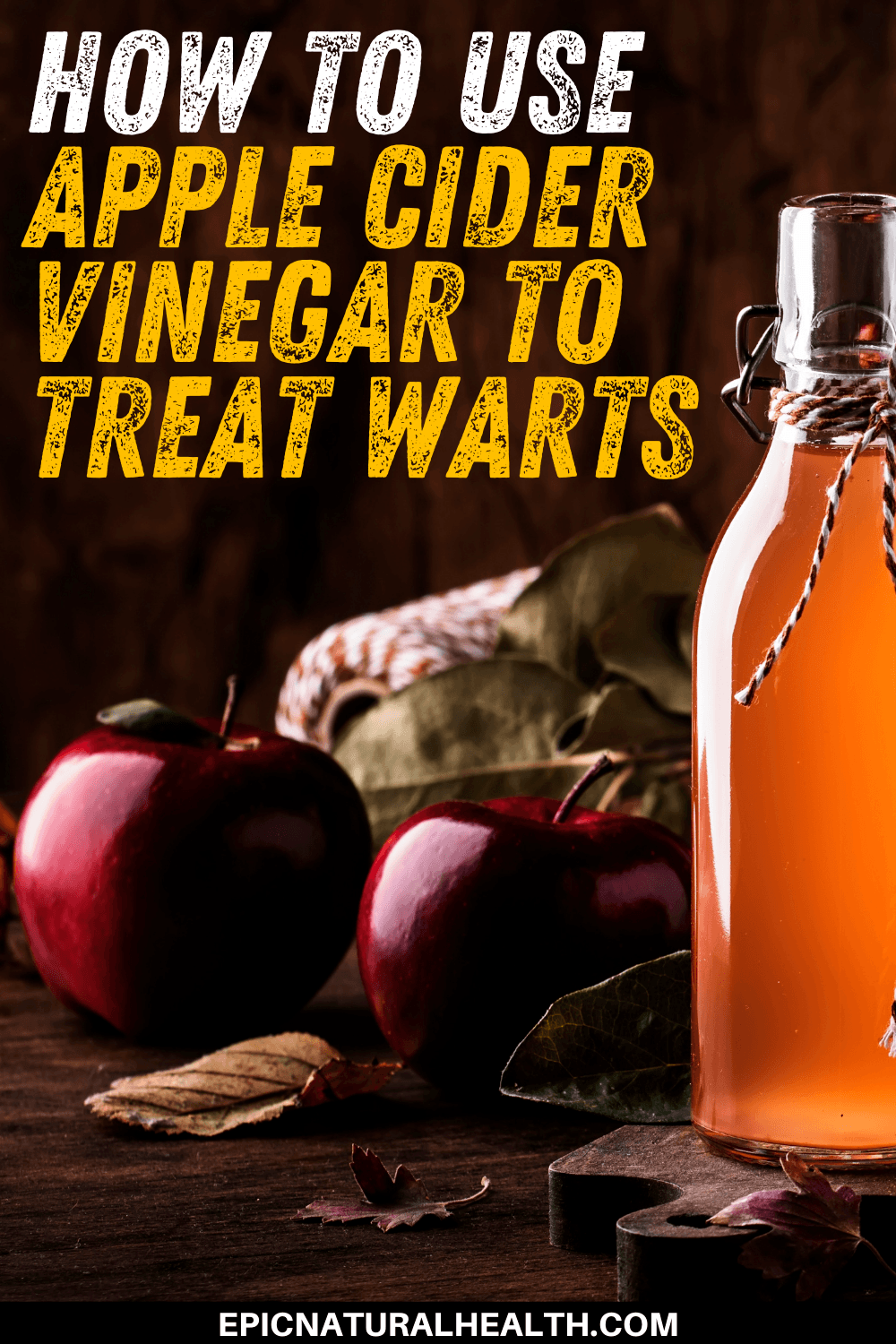 How To Get Rid Of Warts Using Apple Cider Vinegar Fast Epic Natural