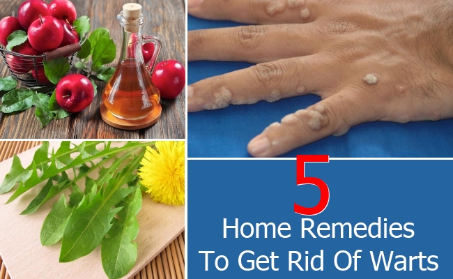 Top 5 Home Remedies To Get Rid Of Warts Find Home Remedy And Supplements