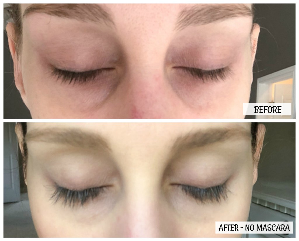 Rodan Fields Lash Boost Before And After All You Need Infos